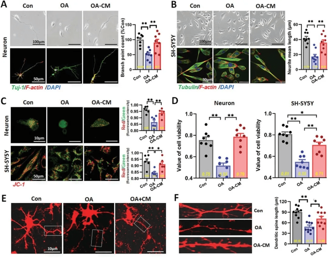 Adv Sci：干细胞治疗阿尔兹海默症的分子机理_hUC-MSCs