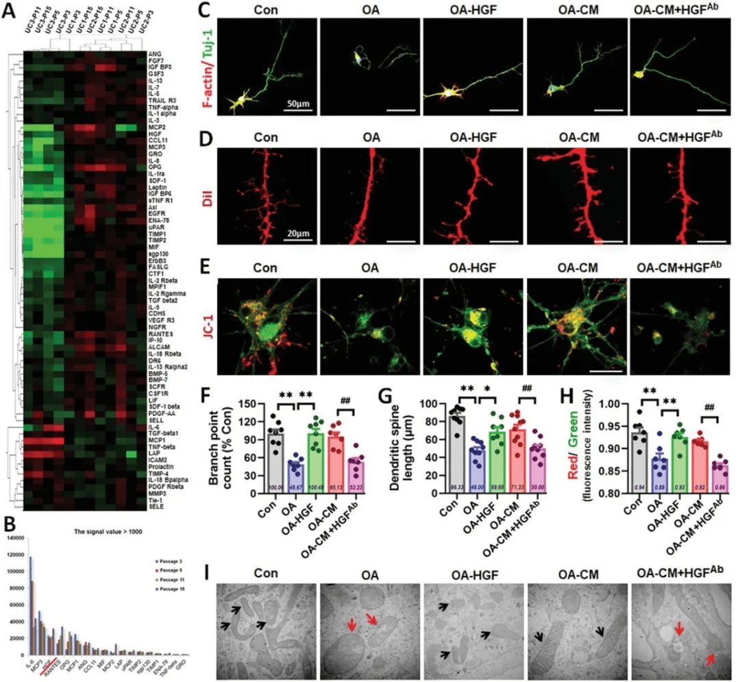 Adv Sci：干细胞治疗阿尔兹海默症的分子机理_hUC-MSCs