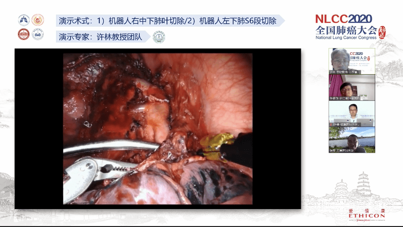 免疫靶向多源并进，开启肺癌治疗新时代 | 全国肺癌大会（NLCC 2020）顺利召开-搜狐大视野-搜狐新闻