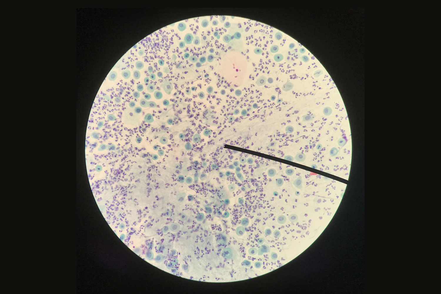 阴道菌群：2020年三大研究进展_Lactin-V