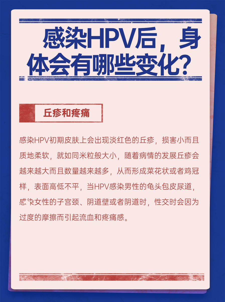 感染hpv后身体会出现哪些变化? 搜狐大视野 搜狐新闻