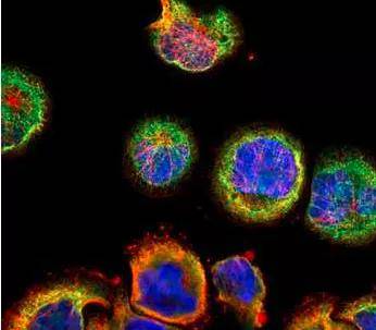 【标志物专栏】内质网标志蛋白质_Gene