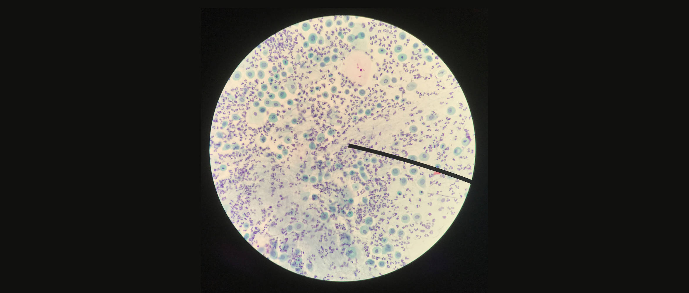 阴道菌群：2020年三大研究进展_Lactin-V