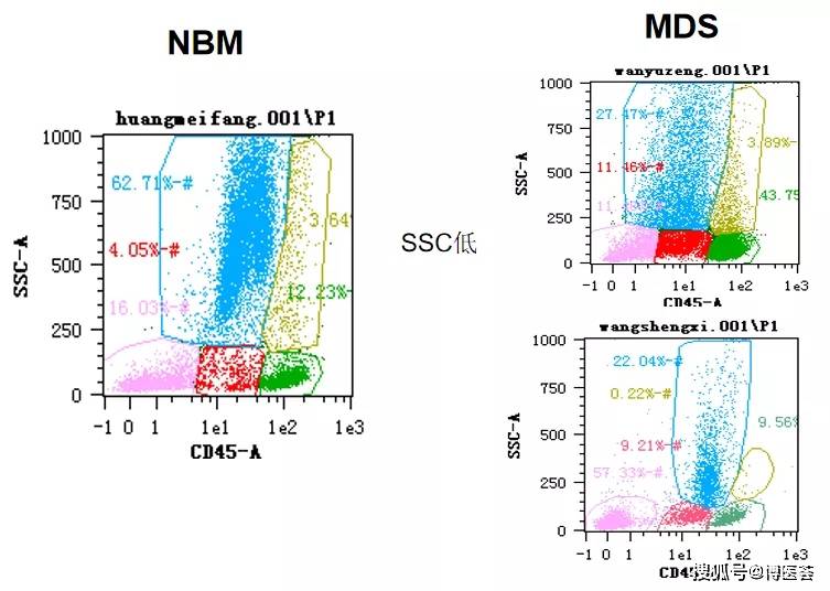 免疫分型在MDS/MPN诊断中的作用有哪些？刘艳荣教授带你一一破解_粒细胞_Ogata_标准