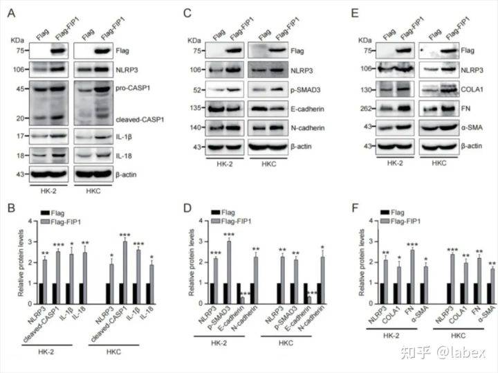 炎症小体NLRP3如何做好？_细胞_蛋白_Caspase-