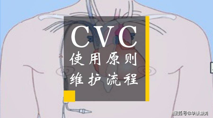 中心静脉导管（CVC）使用原则与维护流程_锁骨_监测_cm