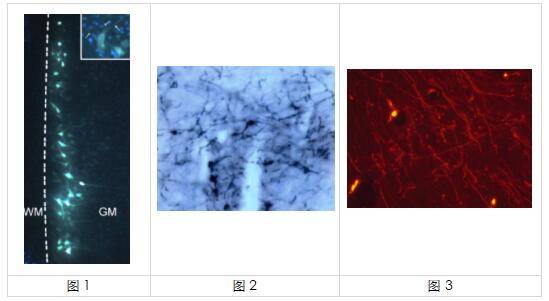 神经元逆行/顺行示踪：艾美捷Fluorochorome方案_荧光_染色_ul