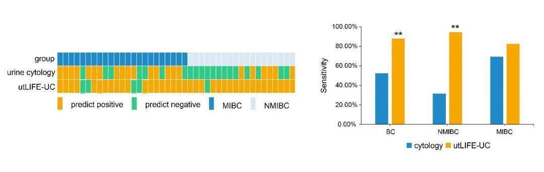 重磅！全球首个尿路上皮癌尿液早筛与疗效监控研究成果发布_utLIFE-UC_患者_模型