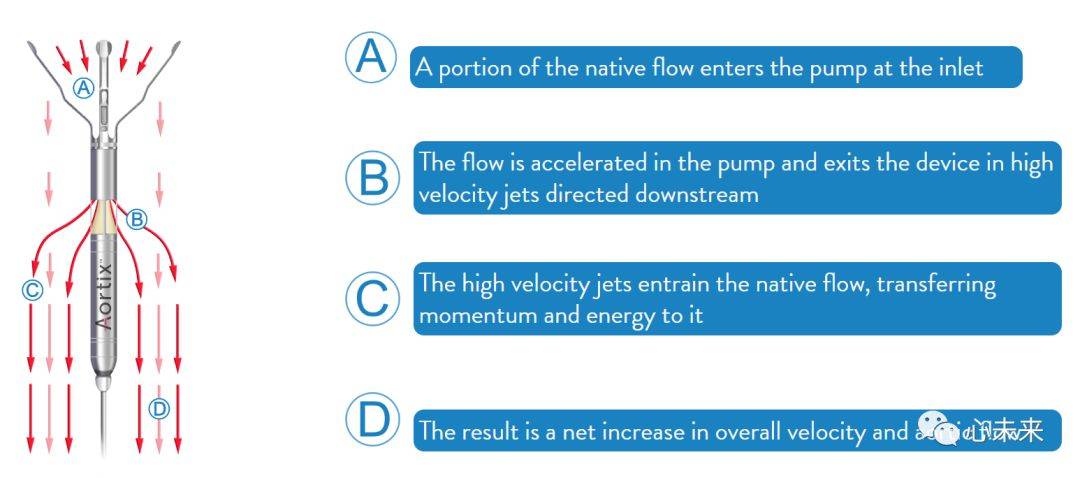 突破！介入泵降低心脏手术急性肾损伤_Aortix_主动脉_公司