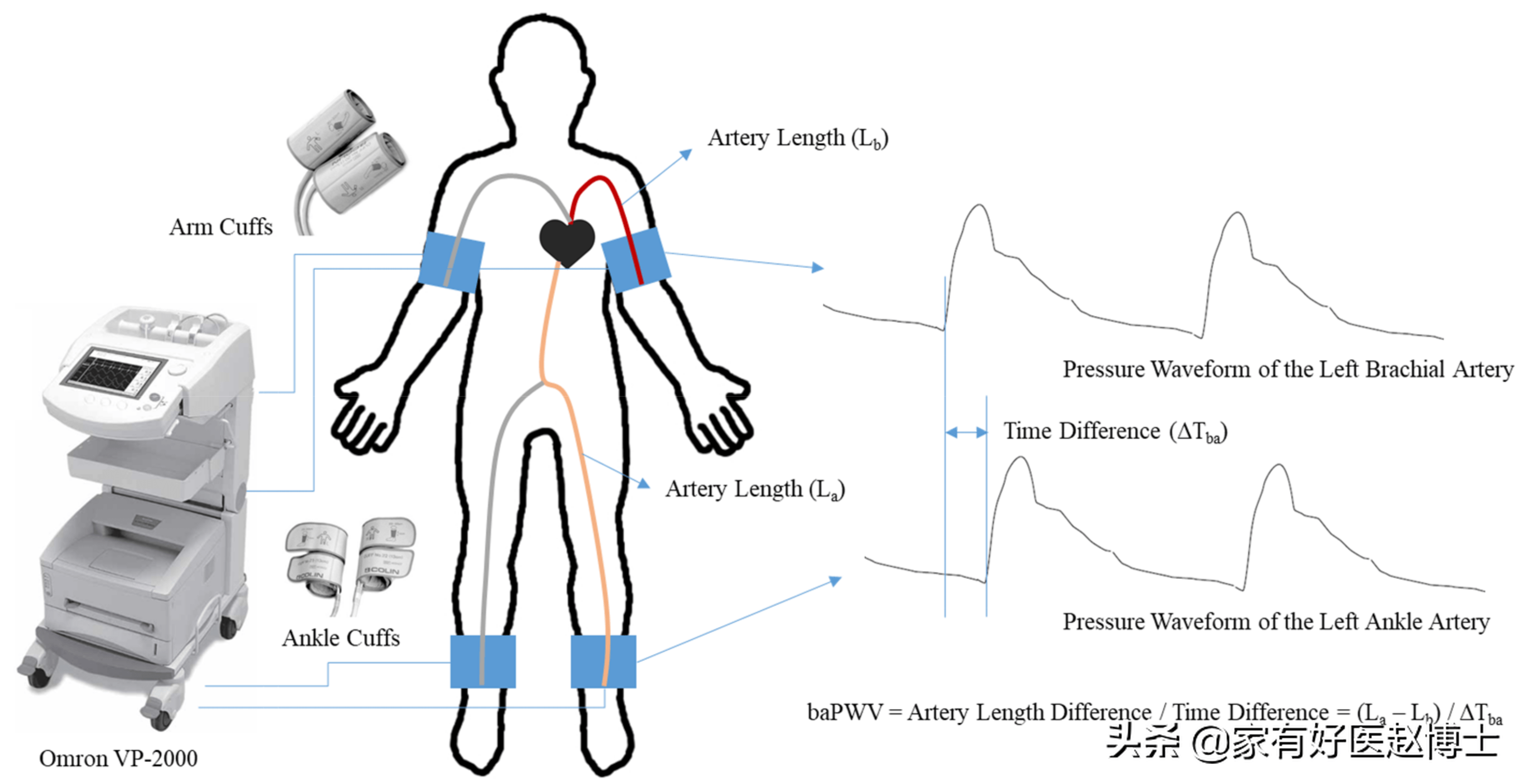 动脉弹性好不好，在家如何自测？延缓动脉硬化，日常怎么做？_脉压_测量_手掌