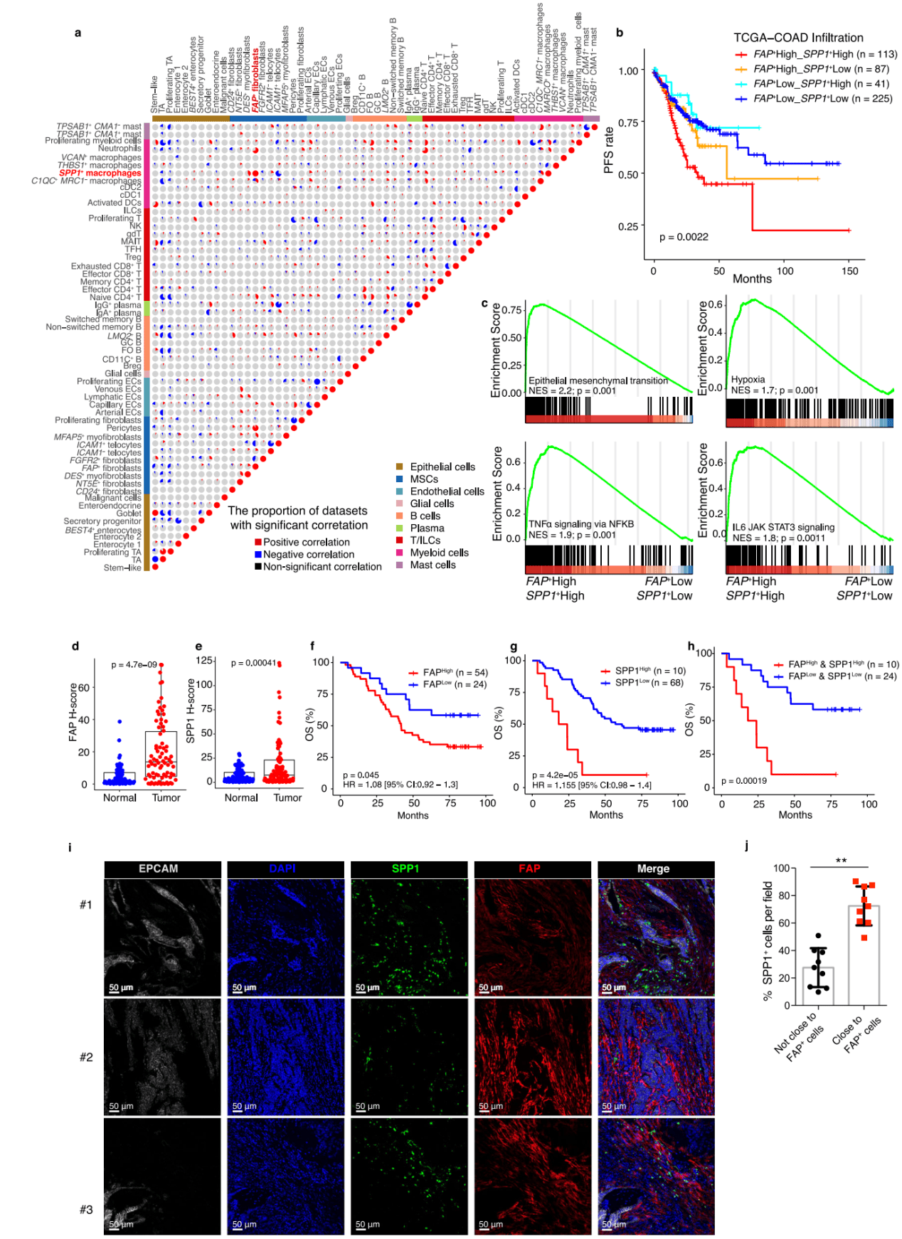 单细胞+空间联合分析 ！揭示结直肠癌中FAP+成纤维细胞和SPP1+巨噬细胞的互作_恶性肿瘤_组织_研究