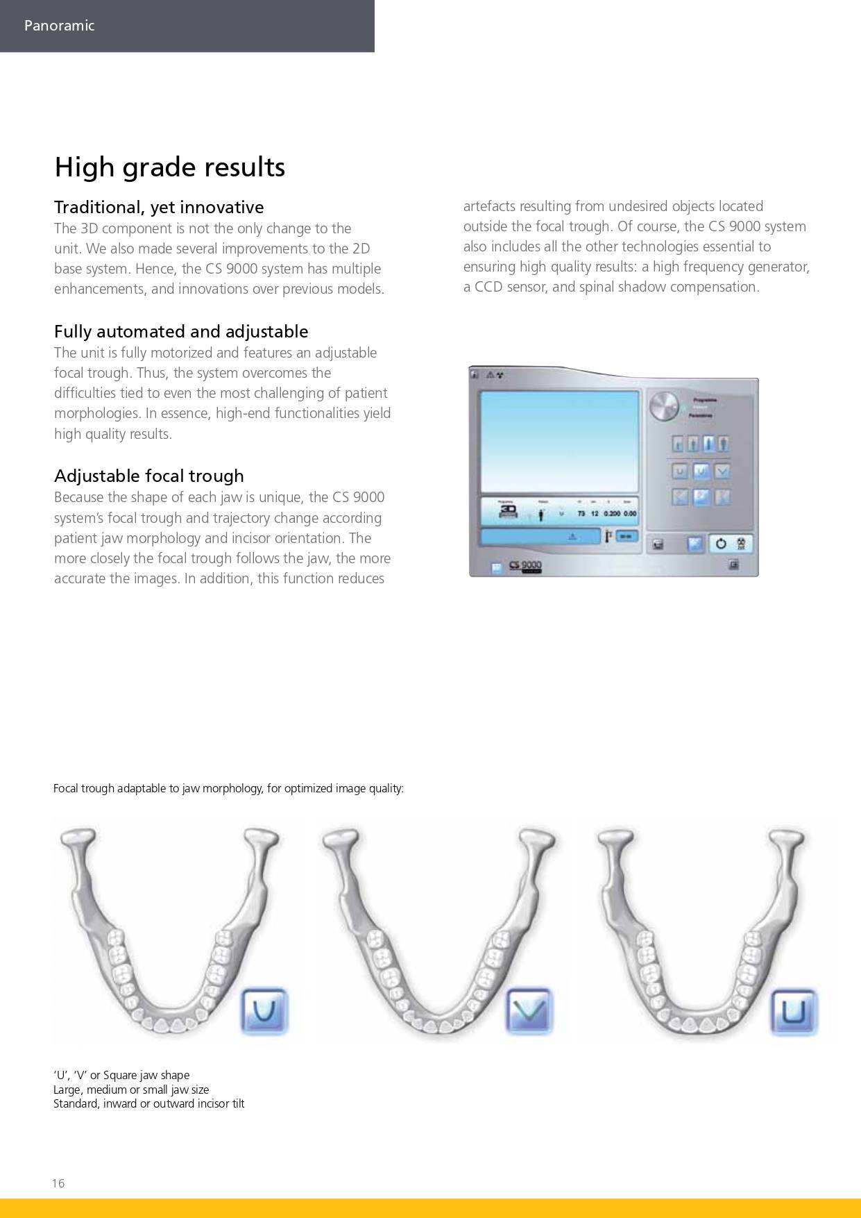 Carestream 9000-搜狐大视野-搜狐新闻