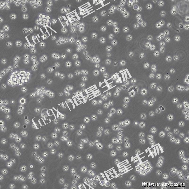 人T淋巴细胞白血病细胞(Jurkat)培养要点_培养基_建议_密度