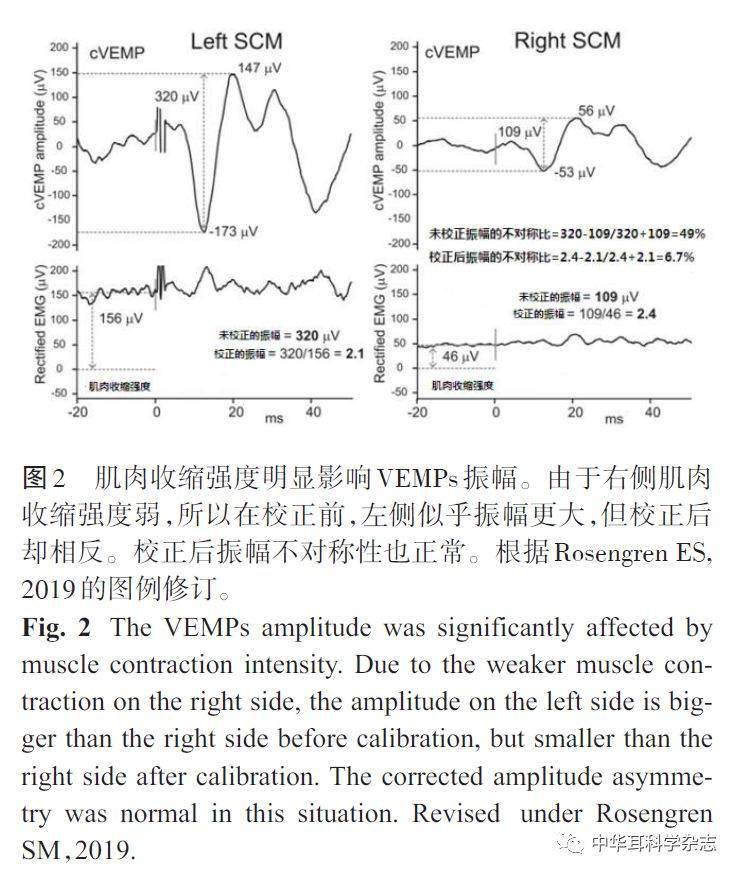 前庭诱发的肌源电位临床应用现状_cVEMPs