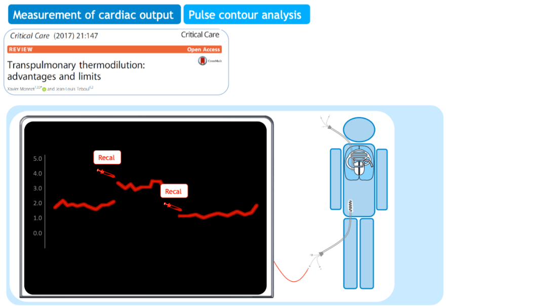 PiCCO在ICU中的应用_进行