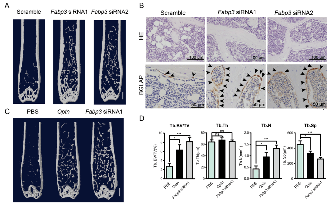 Autophagy丨谢辉教授团队发布自噬调控骨代谢最新研究成果_骨髓