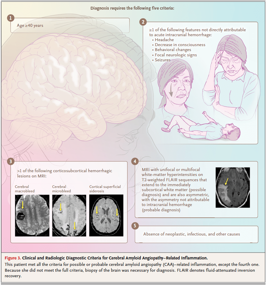 NEJM：这个CAA相关炎症有点难！_Med