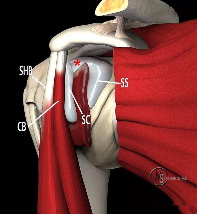 图解肩关节周围滑囊_bursa