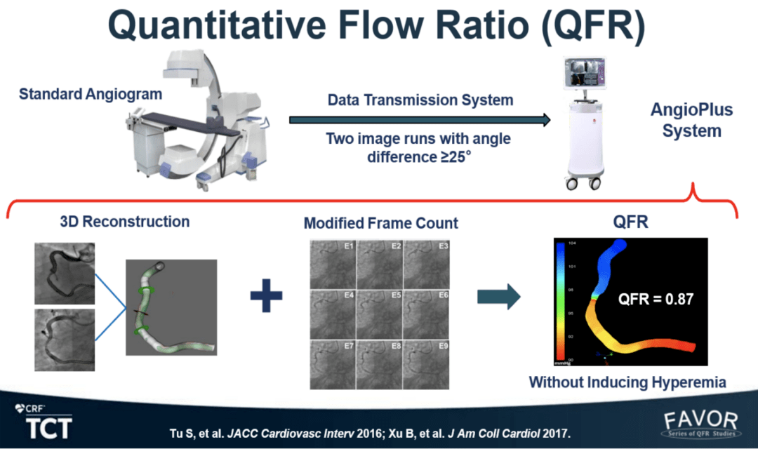 TCT 2021丨FAVOR III China：QFR指导冠状动脉介入治疗可显著改善患者预后_造影