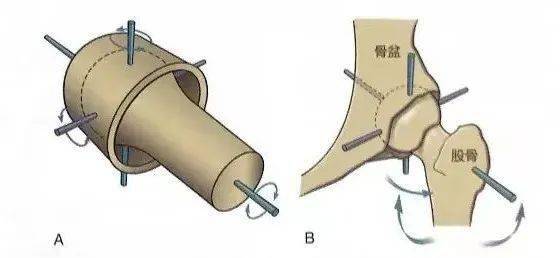 人体关节的结构与功能—必备知识④_骨骼_长骨_身体