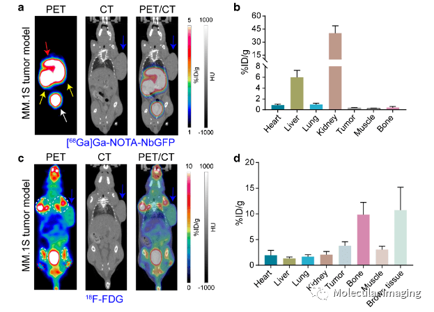 【学术】EJNMMI｜⁶⁸Ga-NOTA-Nb1053多发性骨髓瘤免疫PET成像_肿瘤_进行_探针