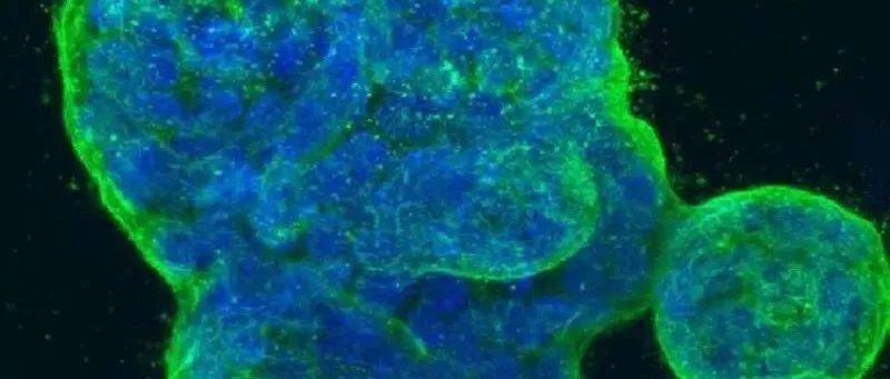 【MOL CANCER】旧药新组合，惠及三阴性乳腺癌患者（雄性激素受体阳性及非阳性）_治疗_研究_亚型