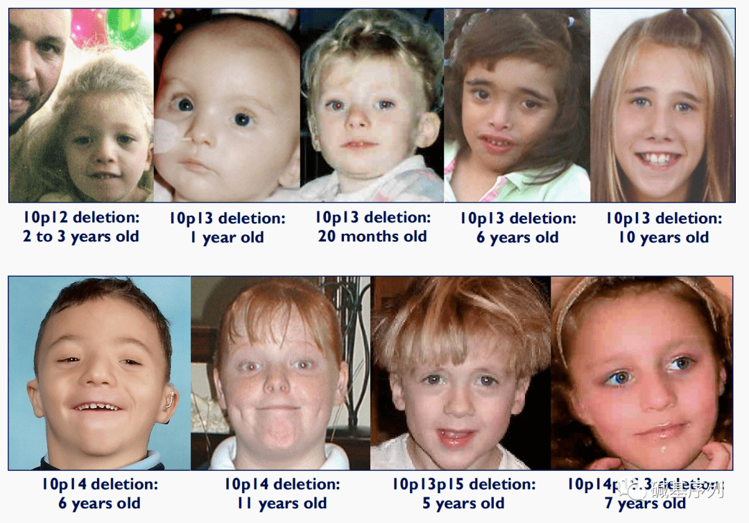 10号染色体及相关疾病_胎儿_体细胞_胎盘