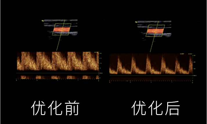 万千视界，无线自由！VINNO P无线掌超开启新传奇_成像_超声_Explore