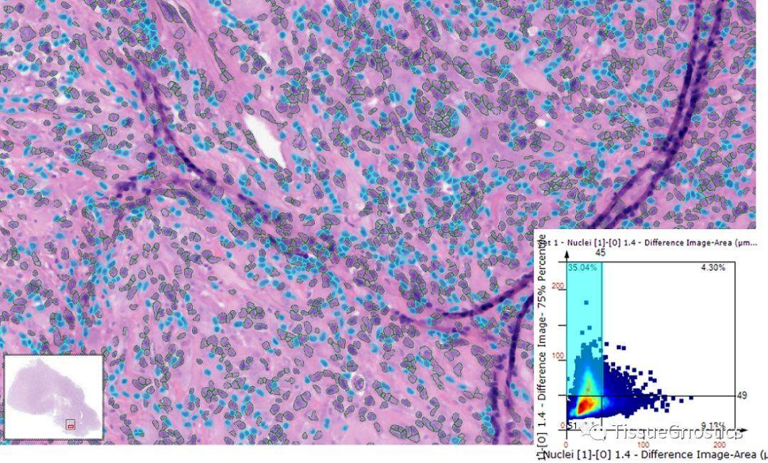 TissueGnostics公司H&E染色样本定量分析实例_识别_苏木_细胞核