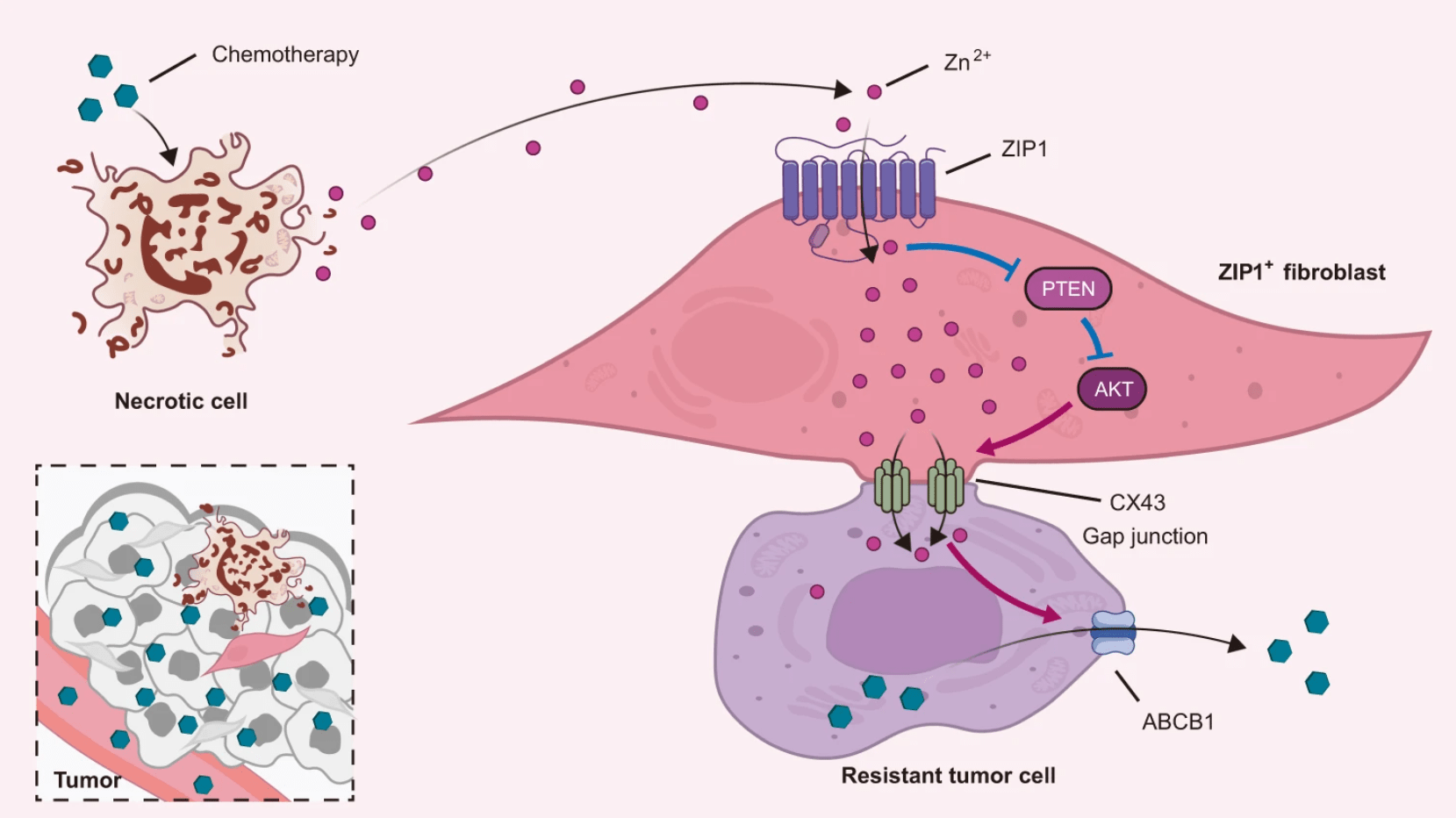格索普插图丨Nature子刊：郑大一附院秦志海团队揭示肺癌化疗耐药性机制_研究_癌细胞_论文