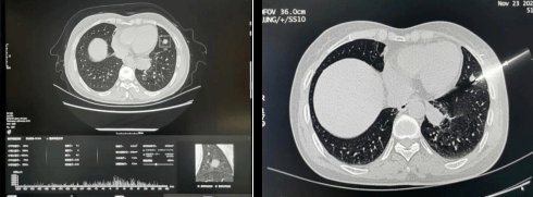 疾病诊断又添“侦察兵”！Optima CT620上线-搜狐大视野-搜狐新闻