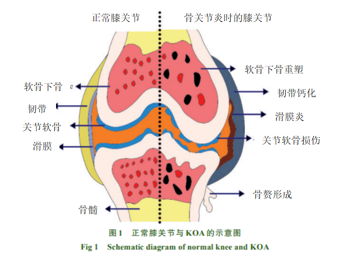 京城药师 | 给膝盖“吃”的药您了解吗？_关节_软骨_保护